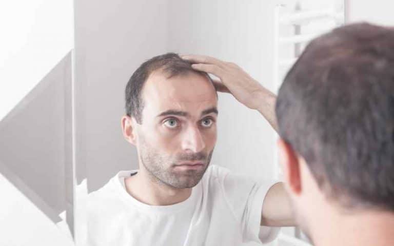 Balding And Thinning At The Crown Hair Loss The Bald Company