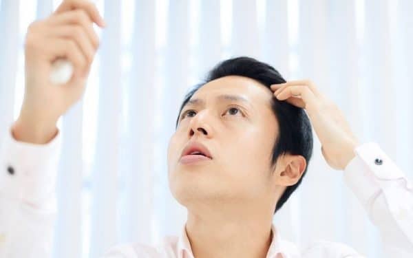 What is DHT? Everything You Need To Know | The Bald Company